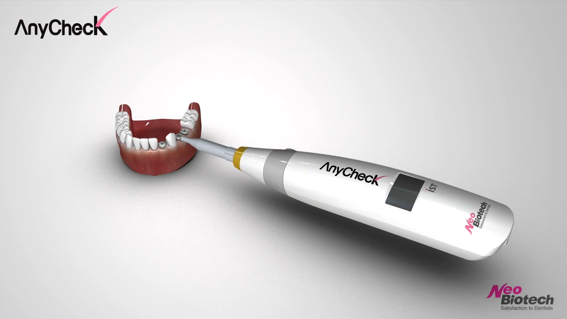 AnyCheck(エニーチェック) | 外科キット | ネオバイオテック インプラント | 和田精密歯研株式会社