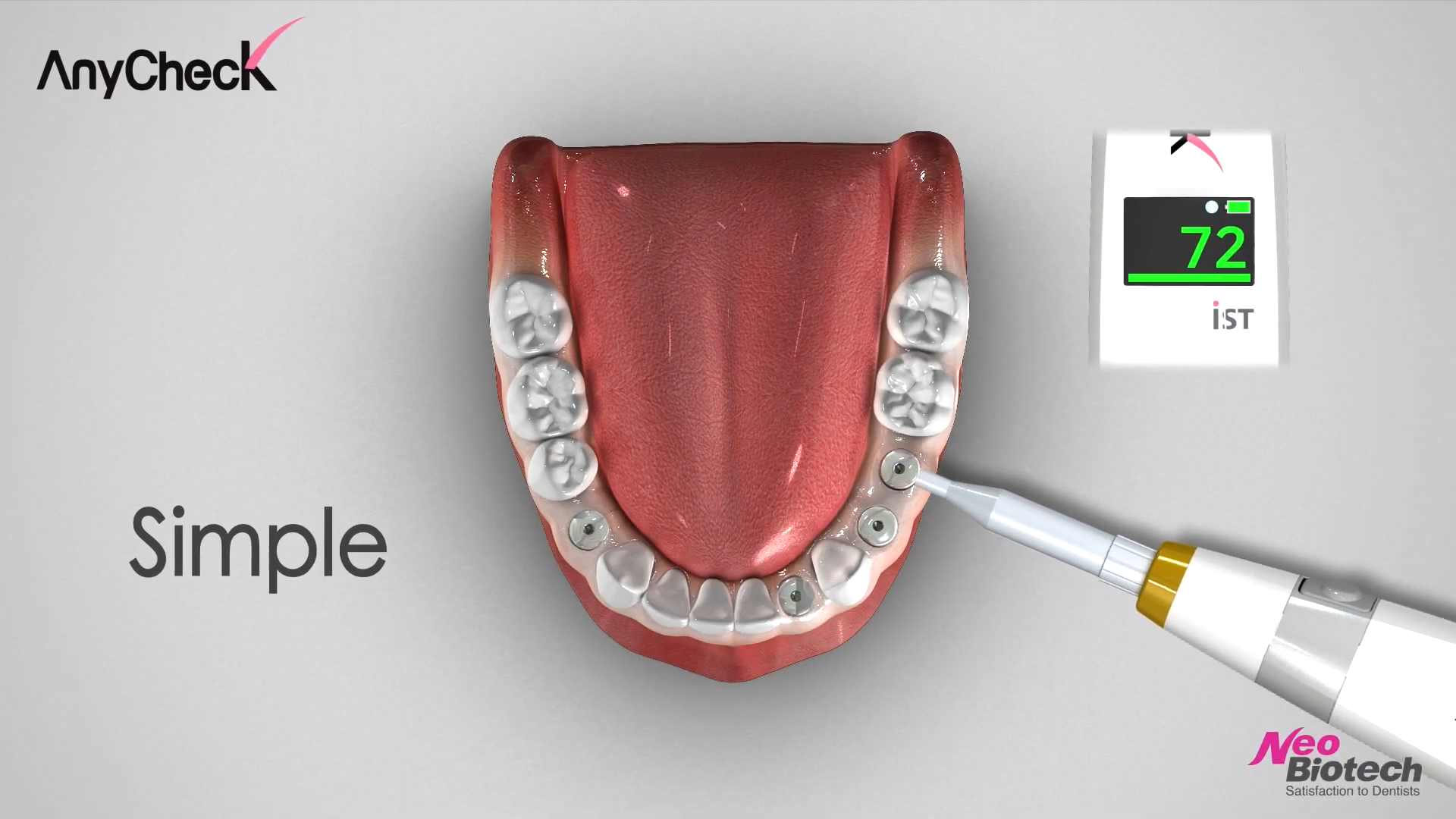 AnyCheck(エニーチェック) | 外科キット | ネオバイオテック インプラント | 和田精密歯研株式会社