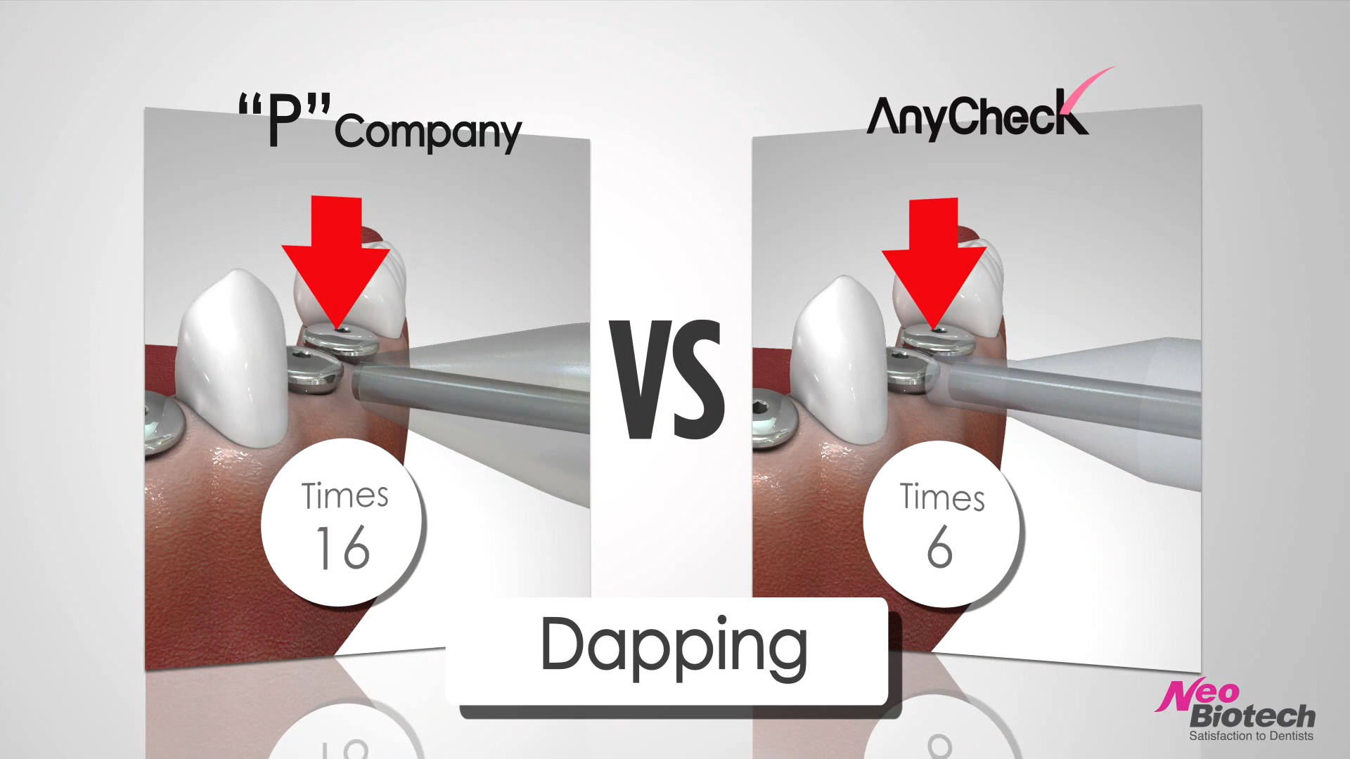 AnyCheck(エニーチェック) | 外科キット | ネオバイオテック インプラント | 和田精密歯研株式会社